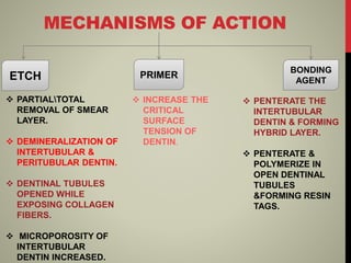 Dentin Bonding agents generations | PPTX
