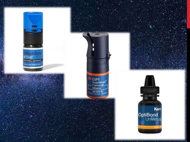 Dentin Bonding agents generations | PPTX | Dental Health | Diseases and ...