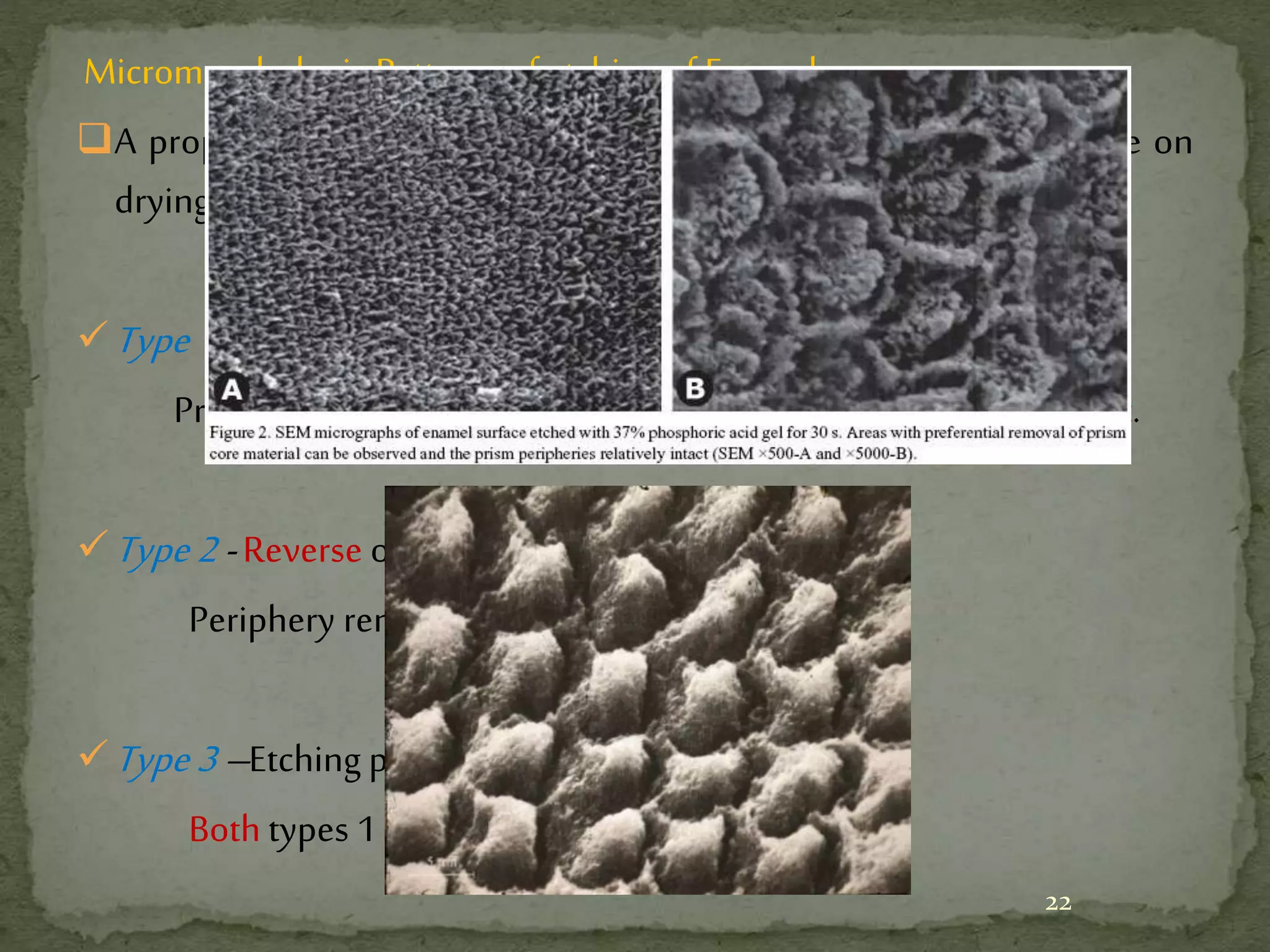 Bonding agents used in dentistry | PPTX