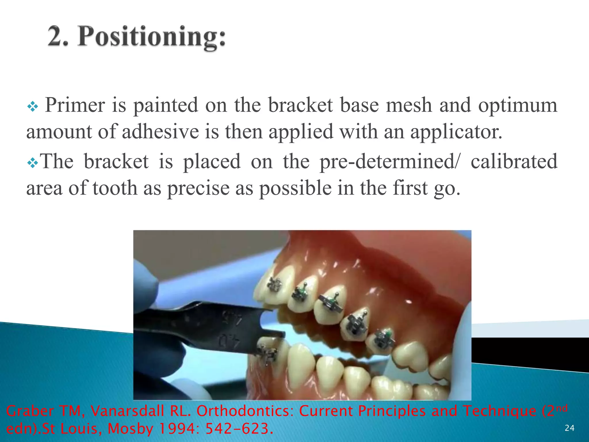 BONDING AGENTS AND BONDING MATERIALS AND RECENT CONCEPT | PPTX