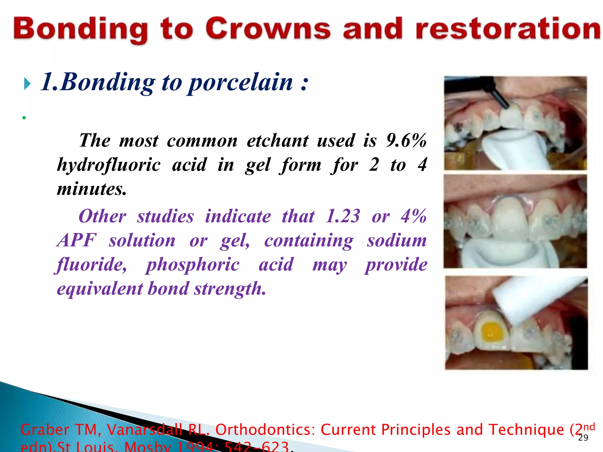 BONDING AGENTS AND BONDING MATERIALS AND RECENT CONCEPT | PPTX