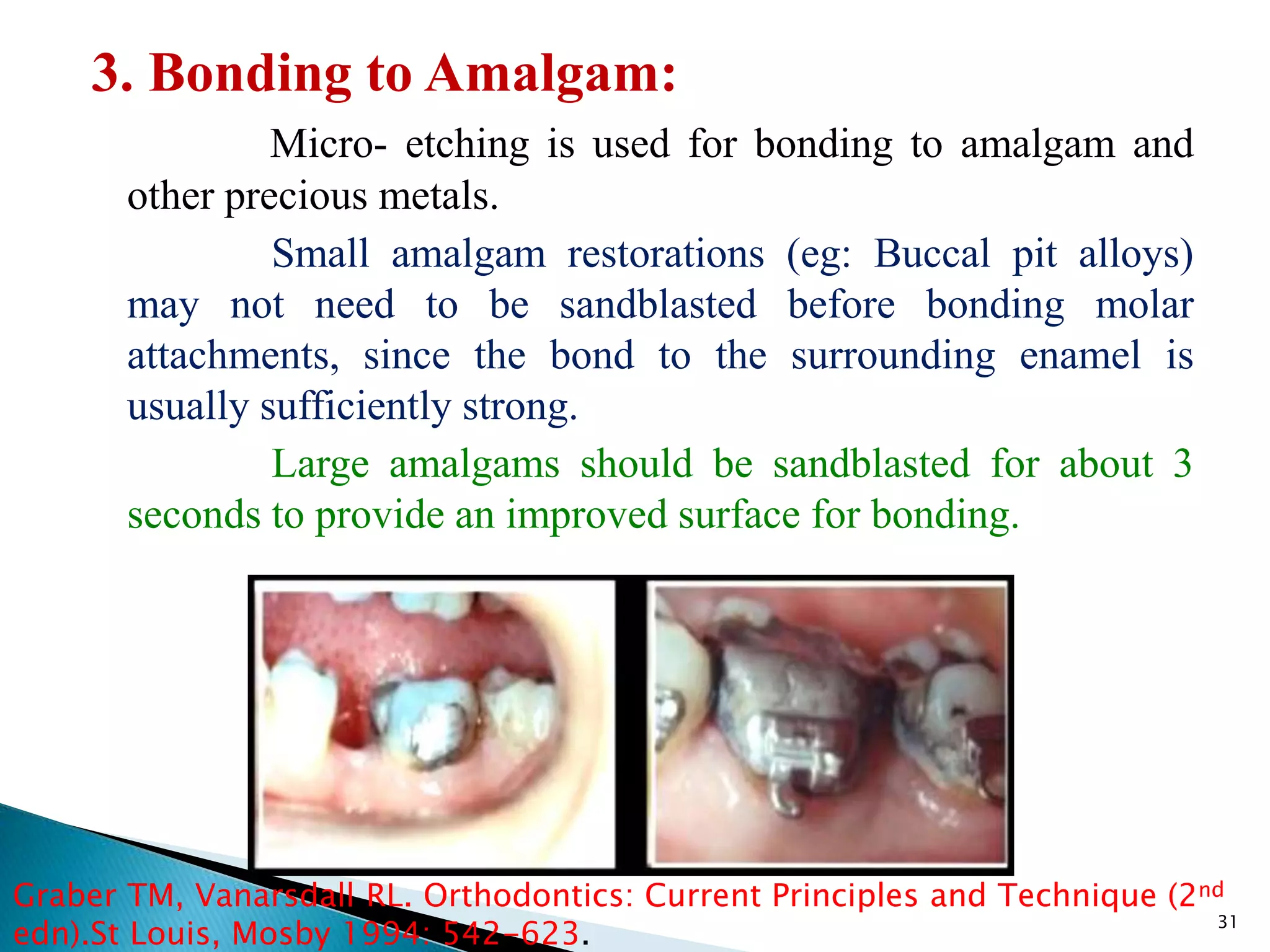 BONDING AGENTS AND BONDING MATERIALS AND RECENT CONCEPT | PPTX
