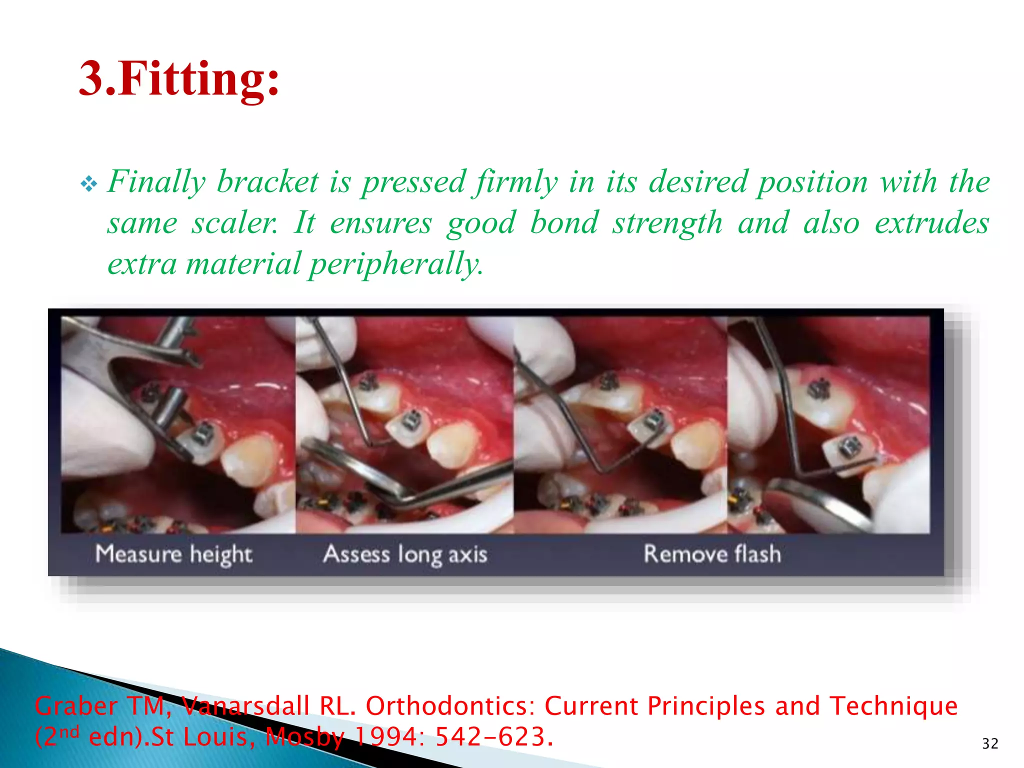BONDING AGENTS AND BONDING MATERIALS AND RECENT CONCEPT | PPTX