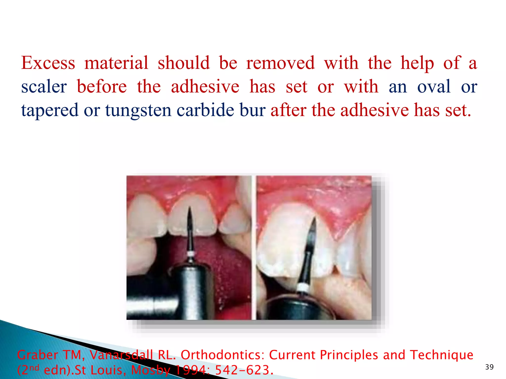 BONDING AGENTS AND BONDING MATERIALS AND RECENT CONCEPT | PPTX