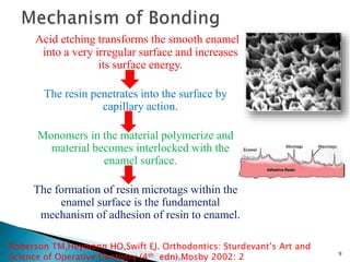 BONDING AGENTS AND BONDING MATERIALS AND RECENT CONCEPT | PPTX