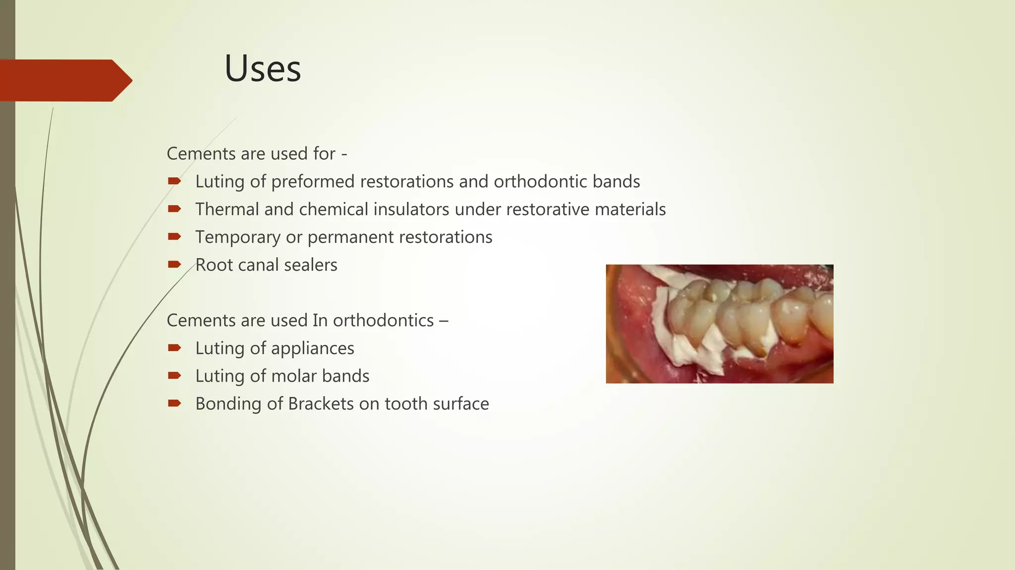 Bonding and banding | PPTX