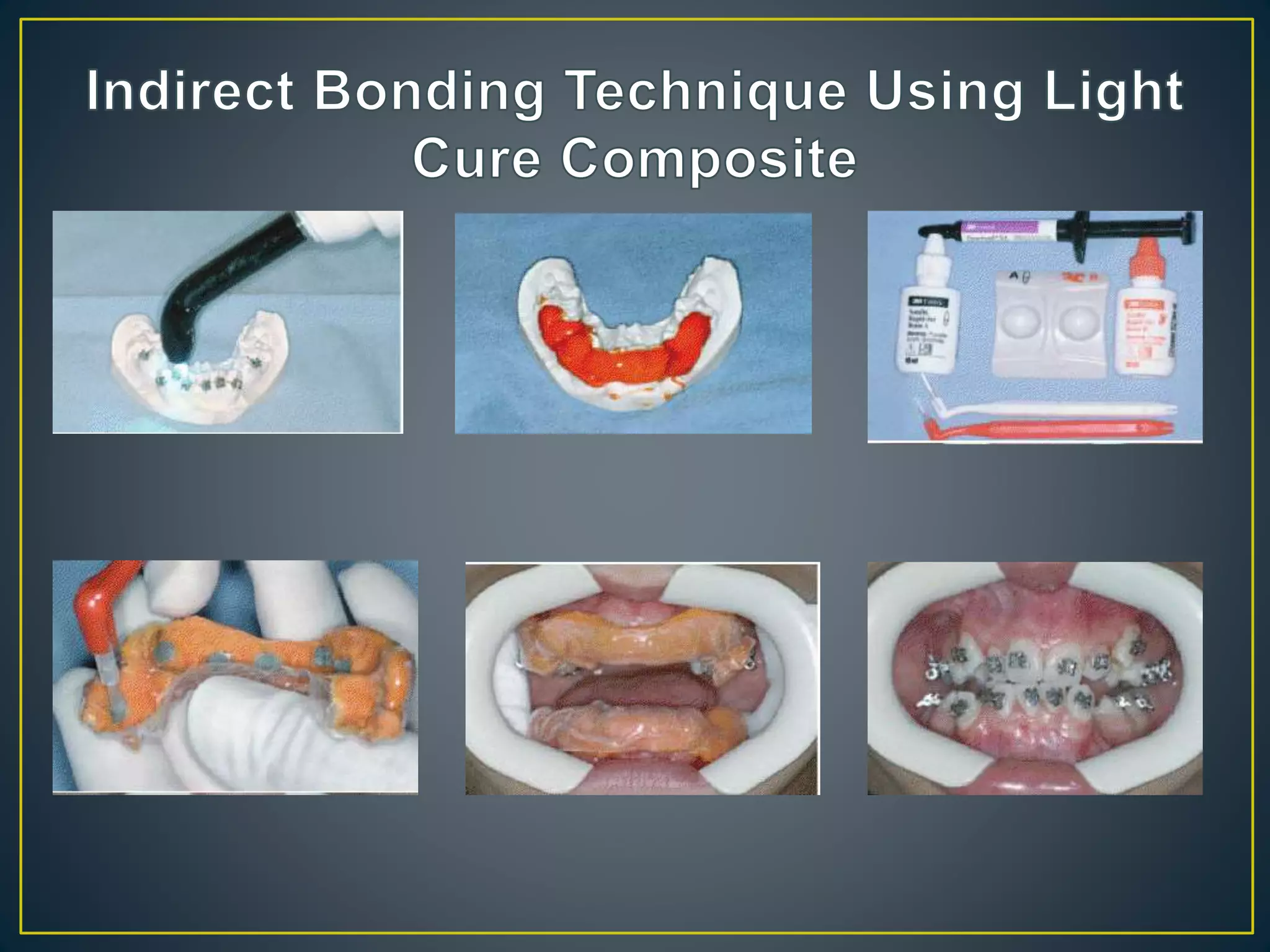 Bonding and debonding in orthodontics | PPTX