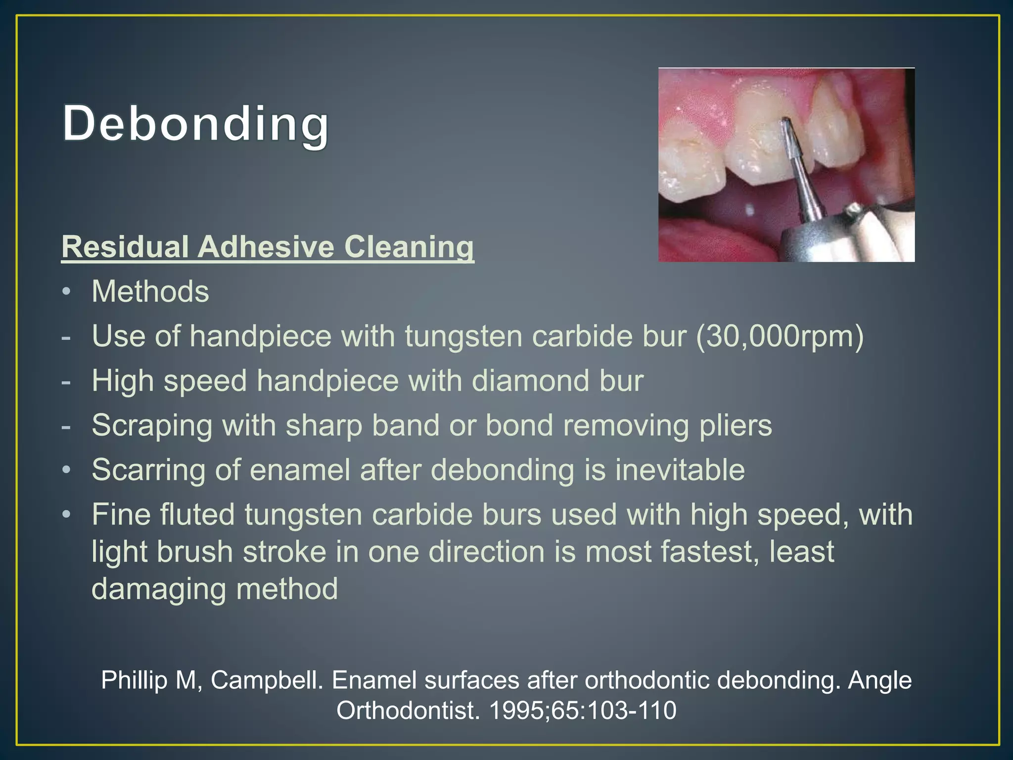 Bonding and debonding in orthodontics | PPTX