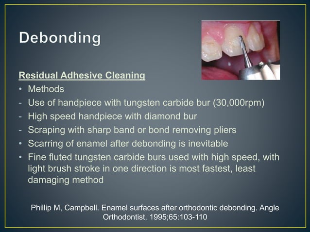 Bonding and debonding in orthodontics | PPTX | Oral care | Personal Care