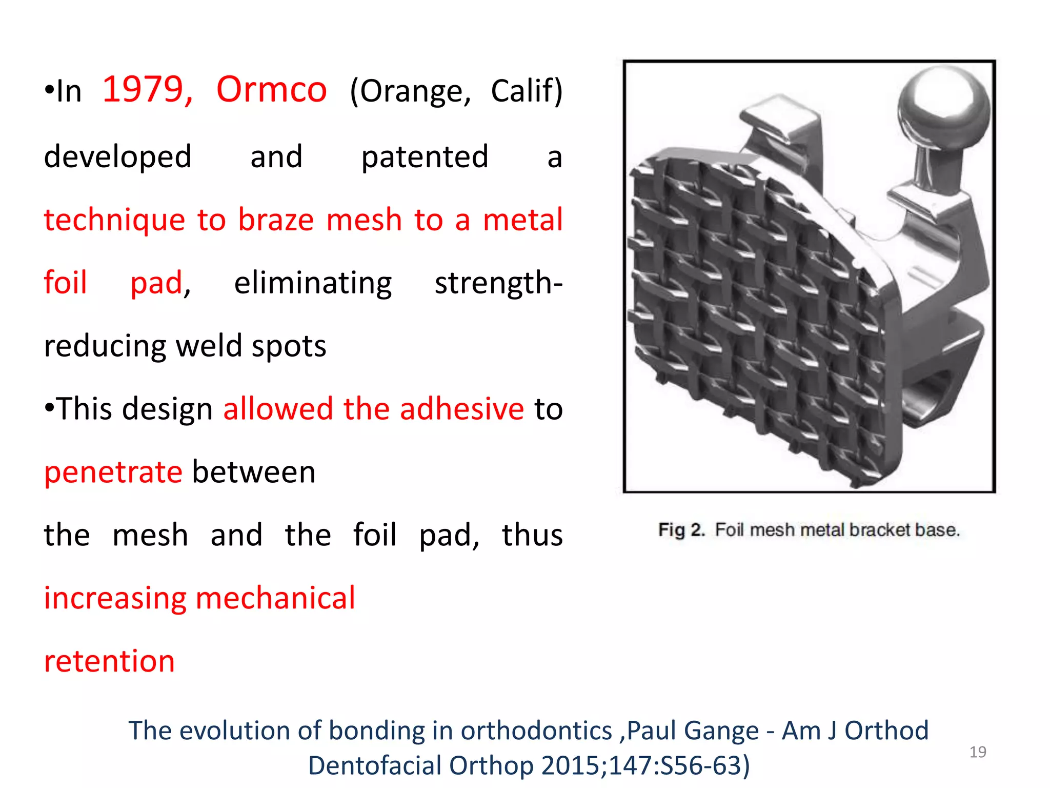 Bonding in Orthodontics | PPTX