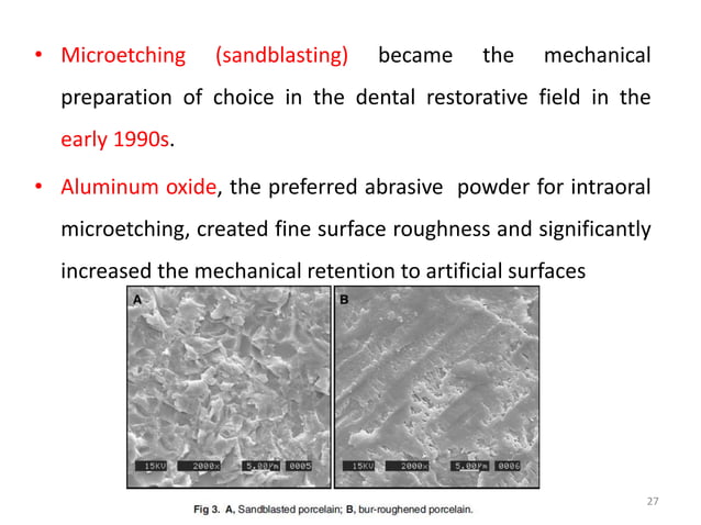 Bonding in Orthodontics | PPTX | Dental Health | Diseases and Conditions