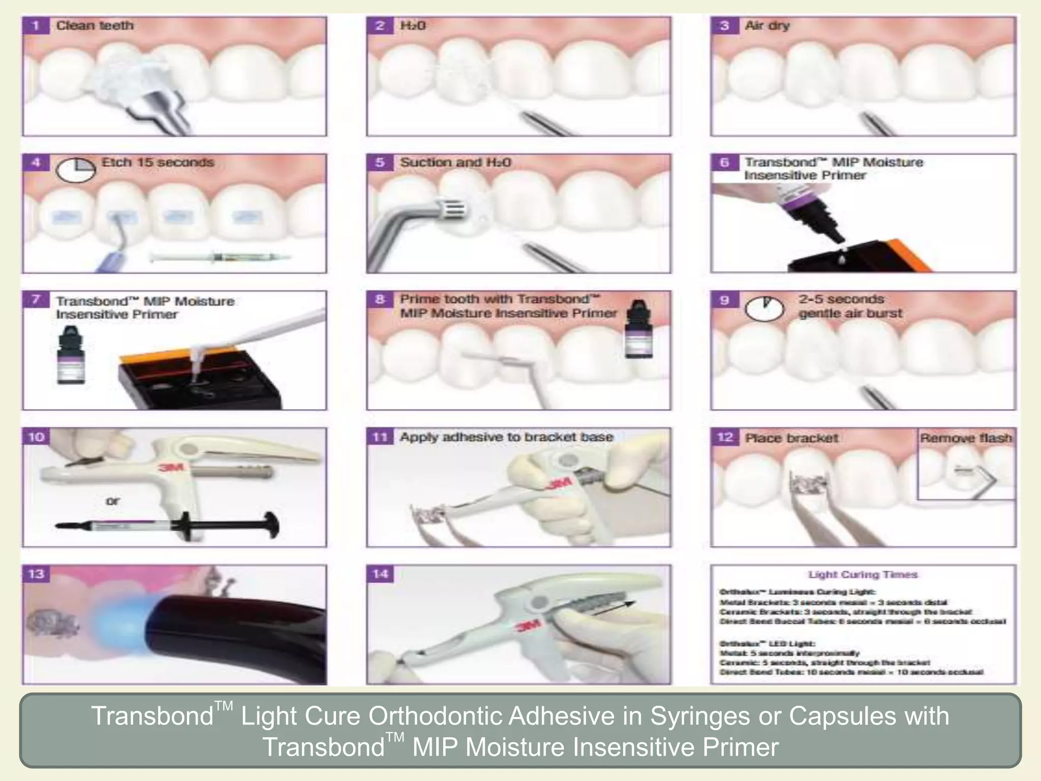 Bonding in orthodontics | PPTX