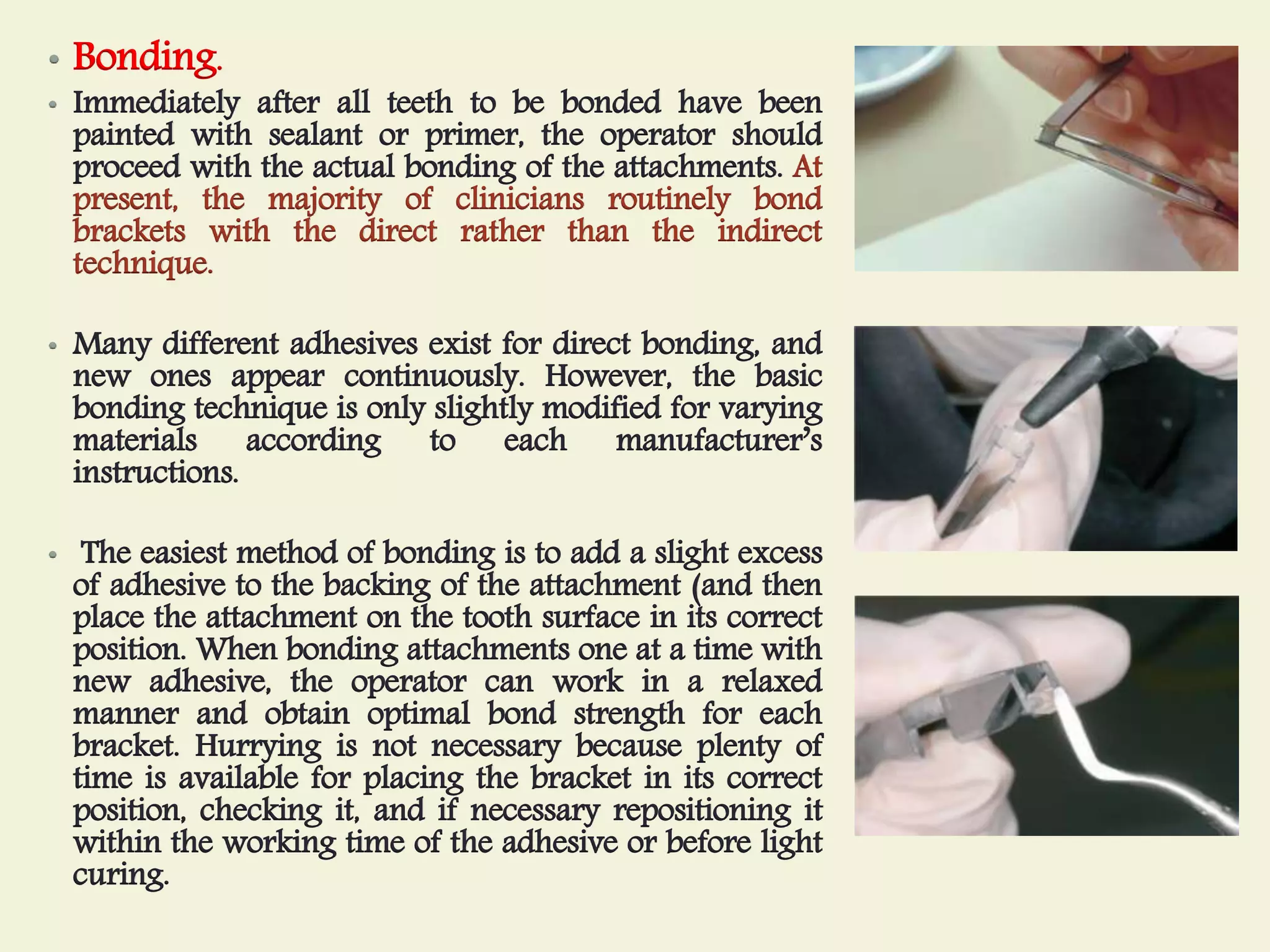 Bonding in orthodontics | PPTX