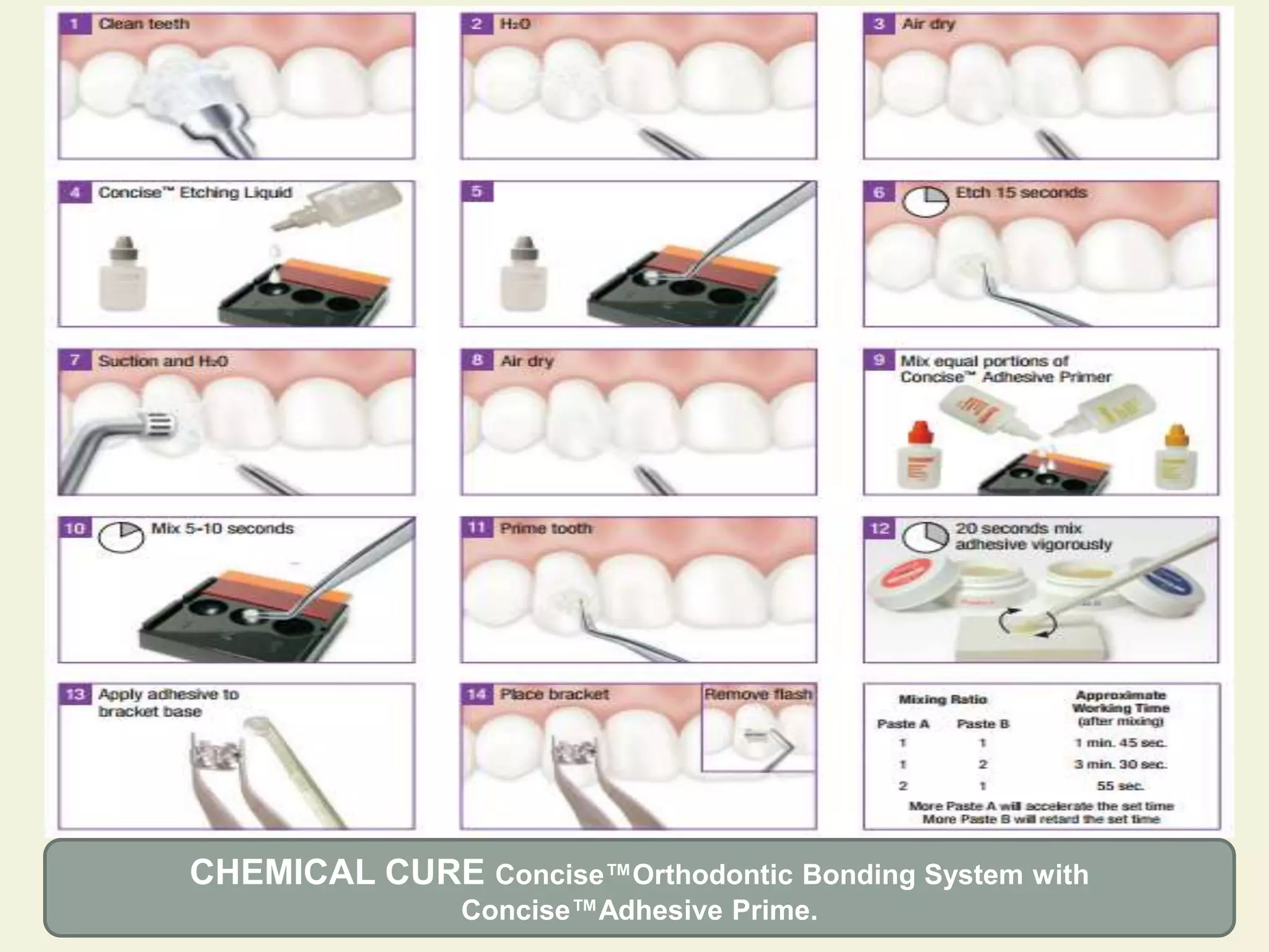 Bonding in orthodontics | PPTX