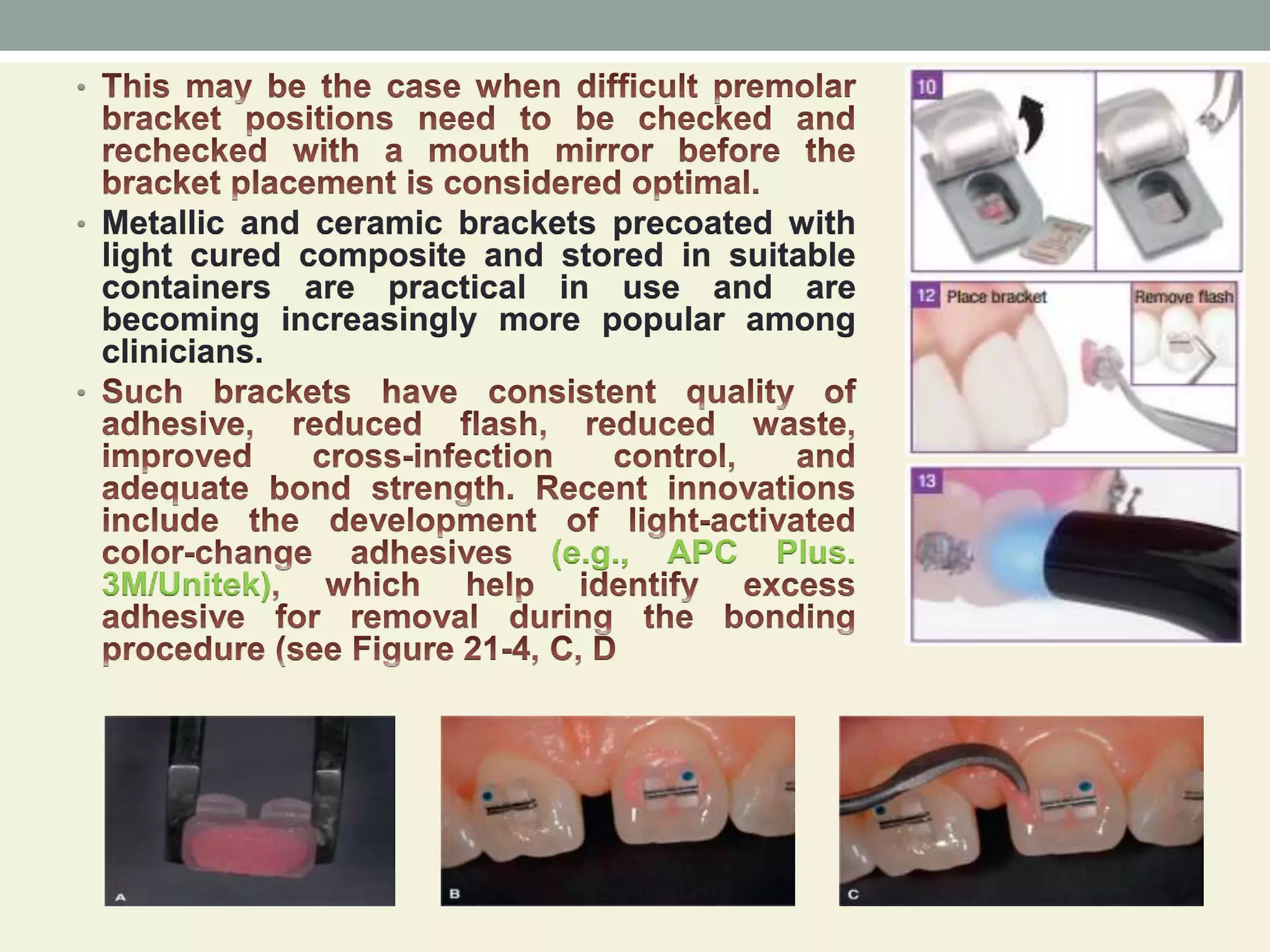 Bonding in orthodontics | PPTX