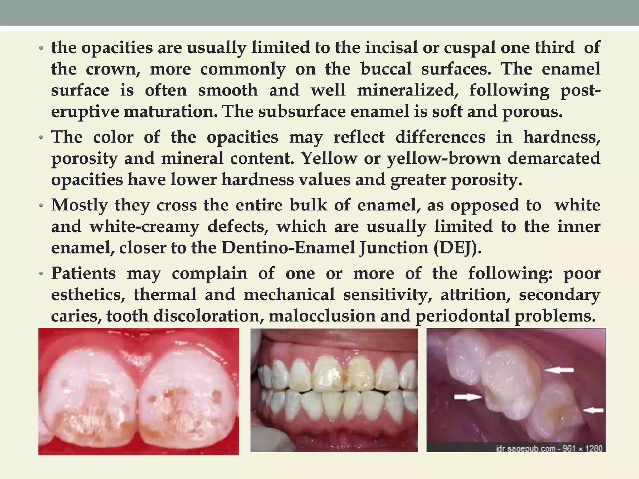 Bonding in orthodontics | PPTX