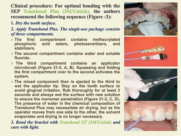 Bonding in orthodontics | PPTX