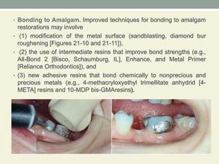 Bonding in orthodontics | PPTX