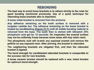 Bonding in orthodontics | PPTX