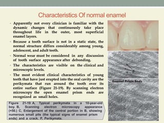Bonding in orthodontics | PPTX