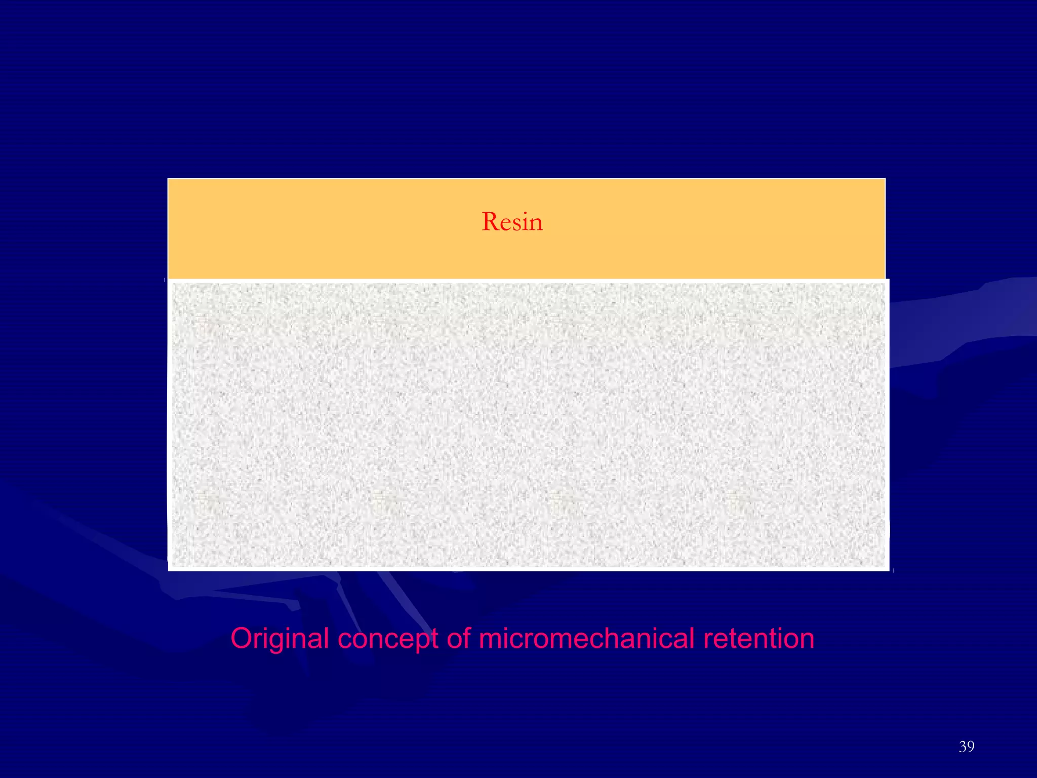 Bonding in orthodontics | PPT