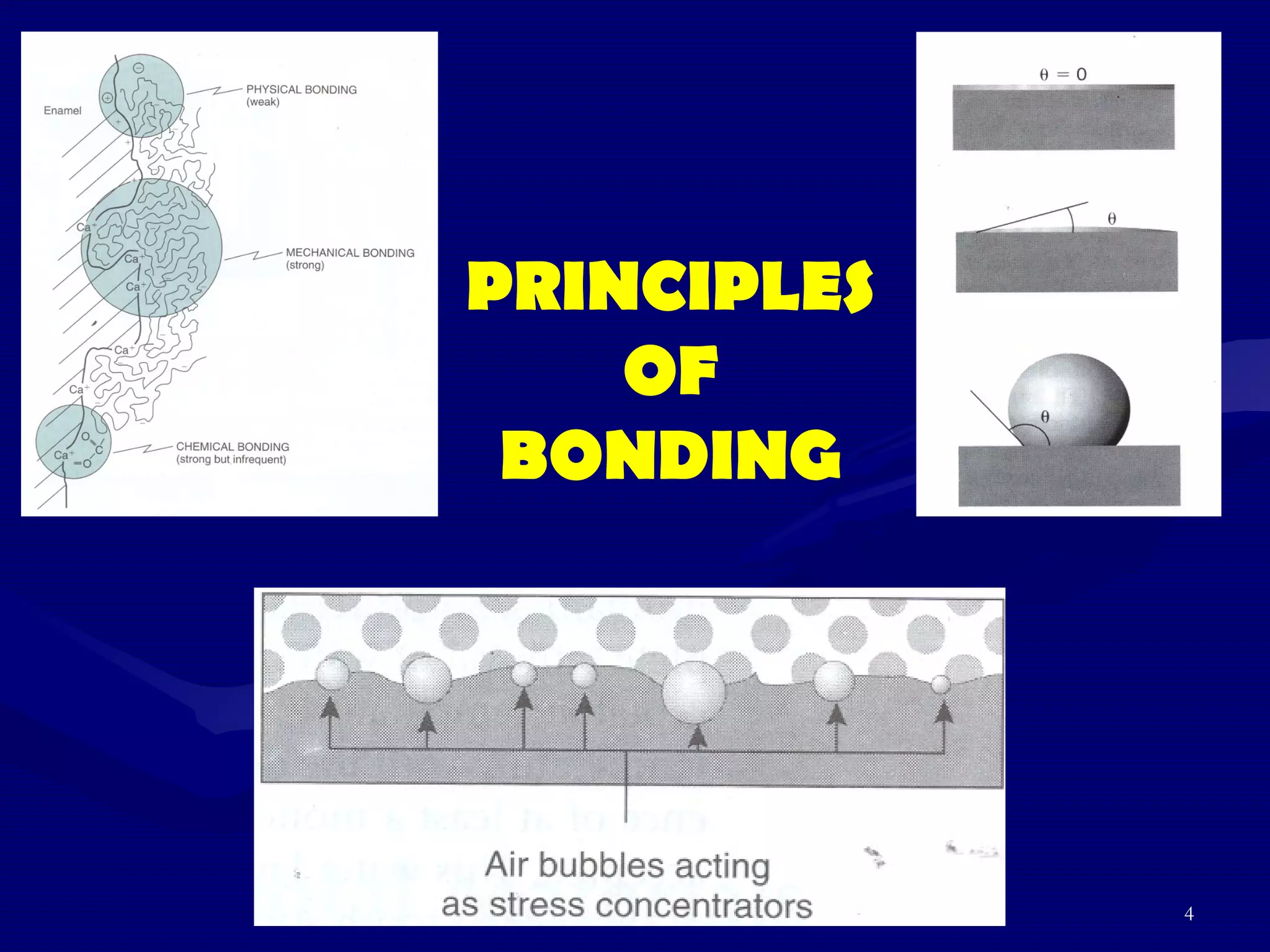Bonding in orthodontics | PPT