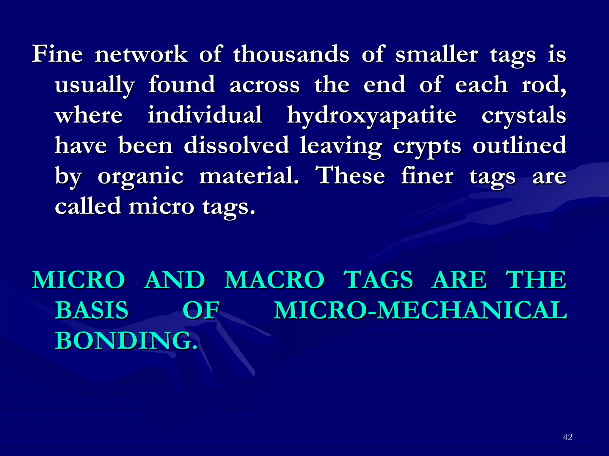 Bonding in orthodontics | PPT