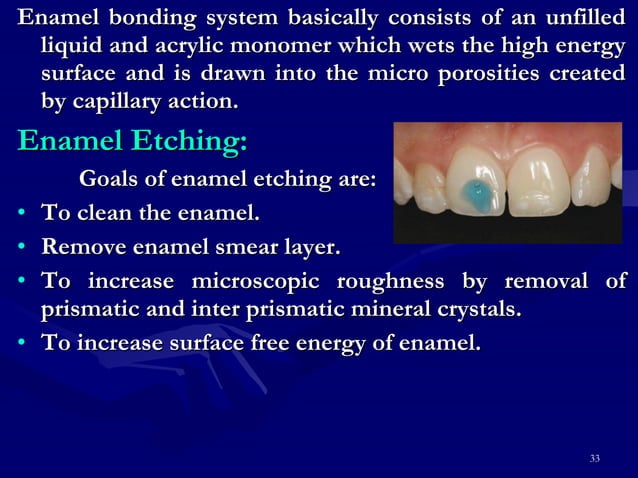 Bonding in orthodontics | PPT