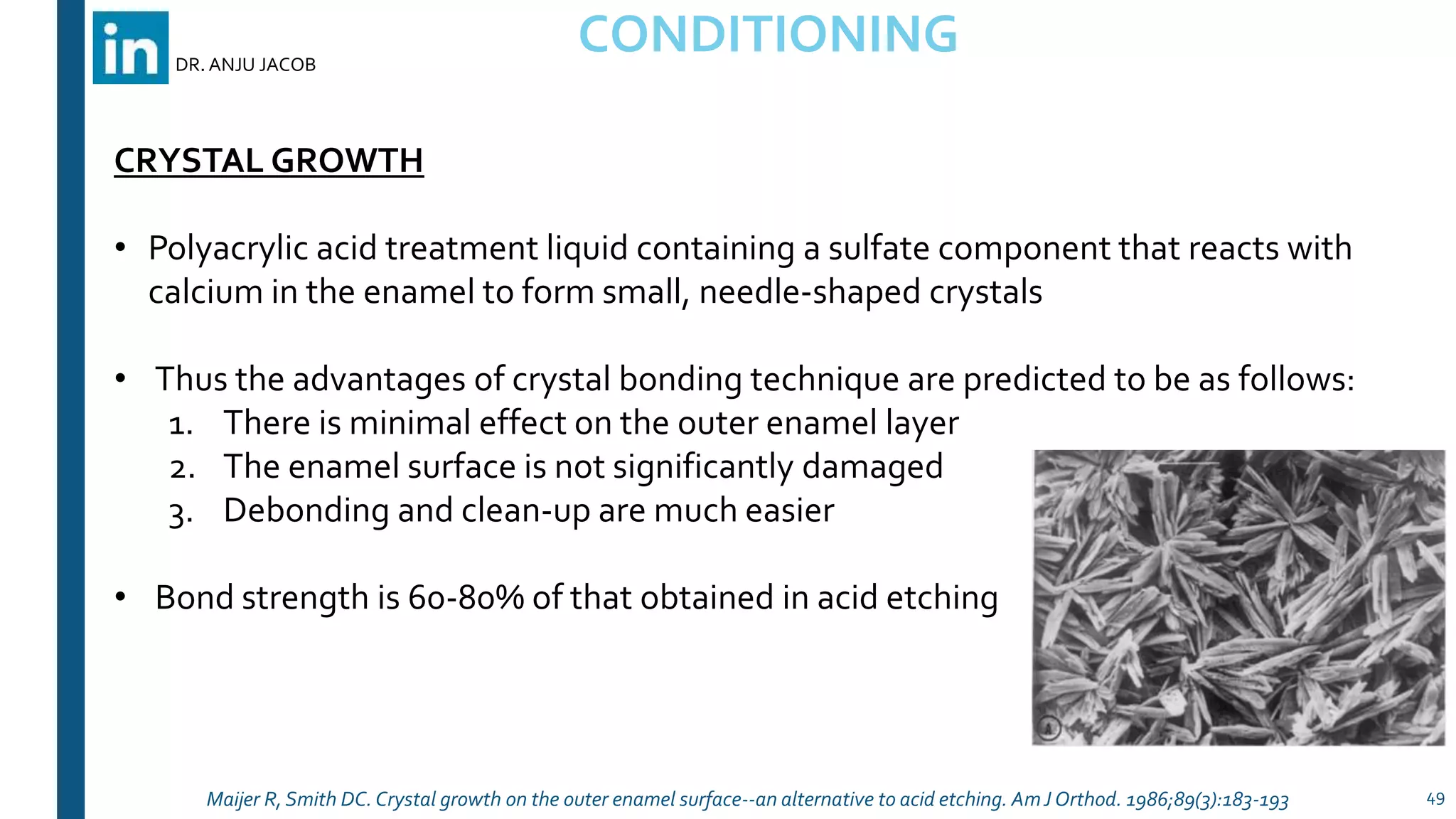 Direct Bonding in Orthodontics | PPTX