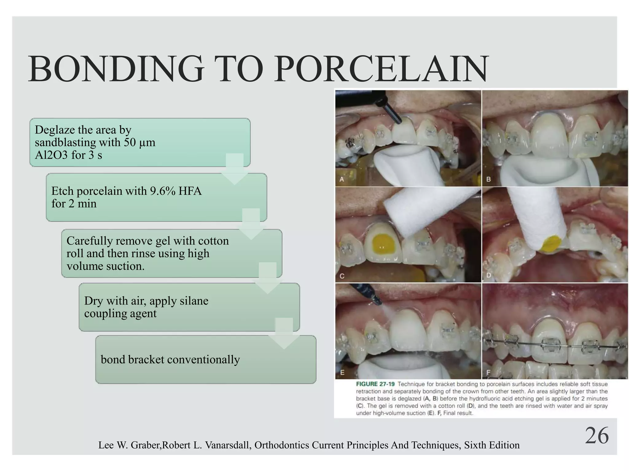 bonding inorthodontics (2).pptx