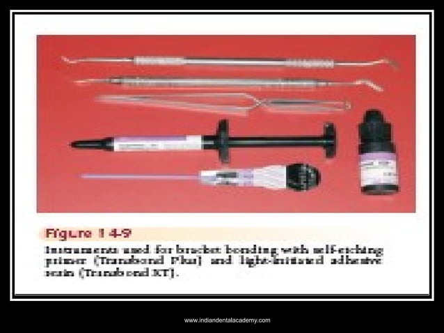 Bonding in orthodontics | PPT | Dental Health | Diseases and Conditions
