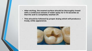 Presentation on Bonding Of Resin Based Materials | PPTX