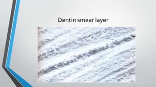 Presentation on Bonding Of Resin Based Materials | PPTX