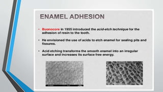 Presentation on Bonding Of Resin Based Materials | PPTX