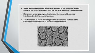 Presentation on Bonding Of Resin Based Materials | PPTX