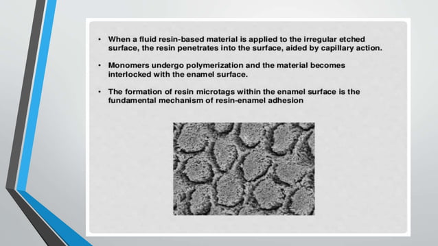 Presentation on Bonding Of Resin Based Materials | PPT