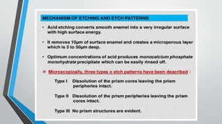 Presentation on Bonding Of Resin Based Materials | PPTX