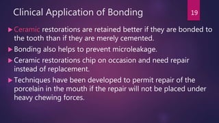 Bonding Systems, Part 2 | PPTX | Dental Health | Diseases and Conditions