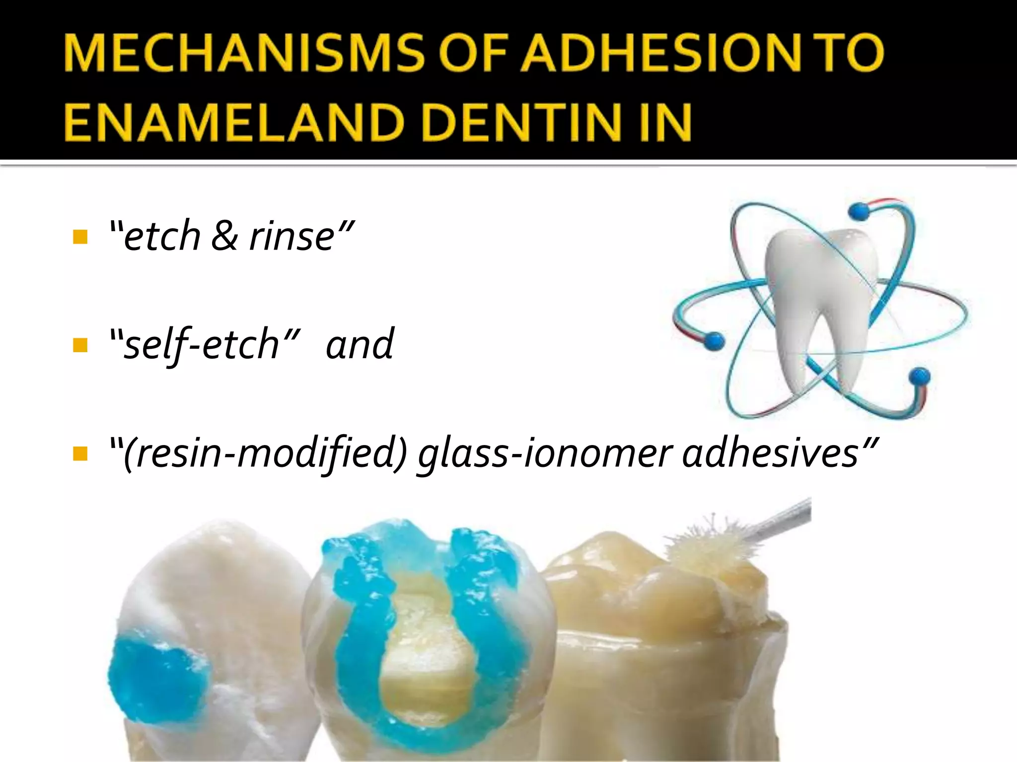 Bonding to enamel and dentin | PPTX