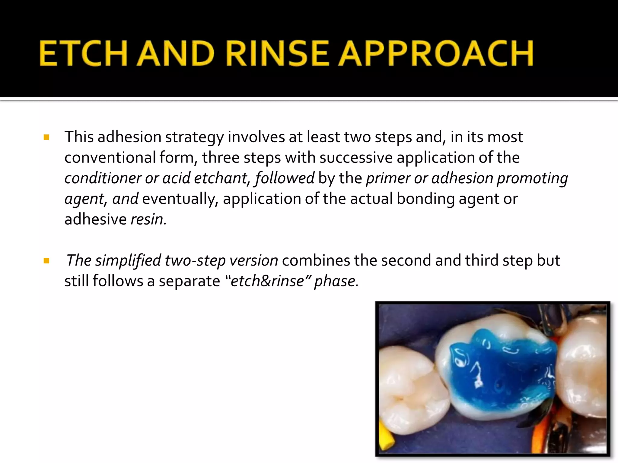 Bonding to enamel and dentin | PPTX