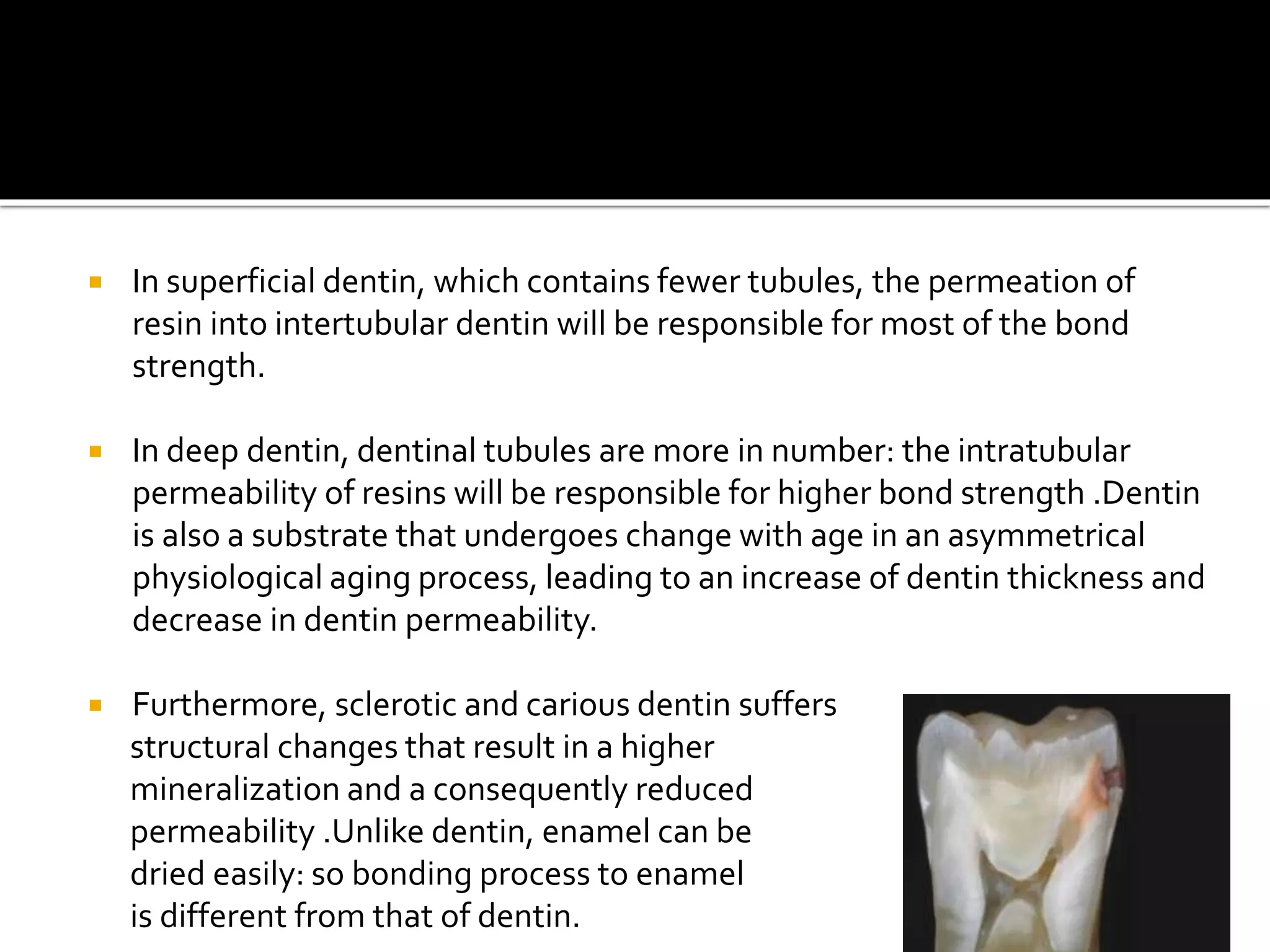 Bonding to enamel and dentin | PPTX