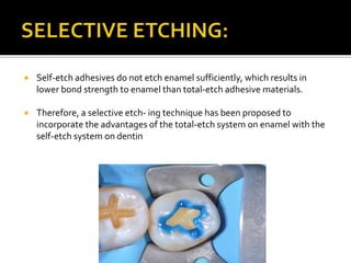Bonding to enamel and dentin | PPTX