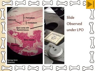 Histology - Specialized Connective Tissues (BONE) | PPTX