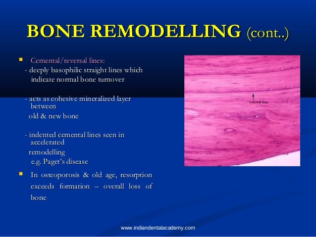 Bone /cosmetic dentistry courses