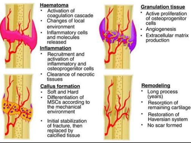 Bone substitutes | PPTX