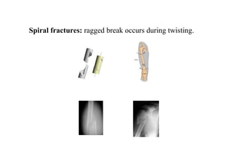 BONE-TYPES,CLASSIFICATION,HISTOLOGY,FRACTURE, | PPT