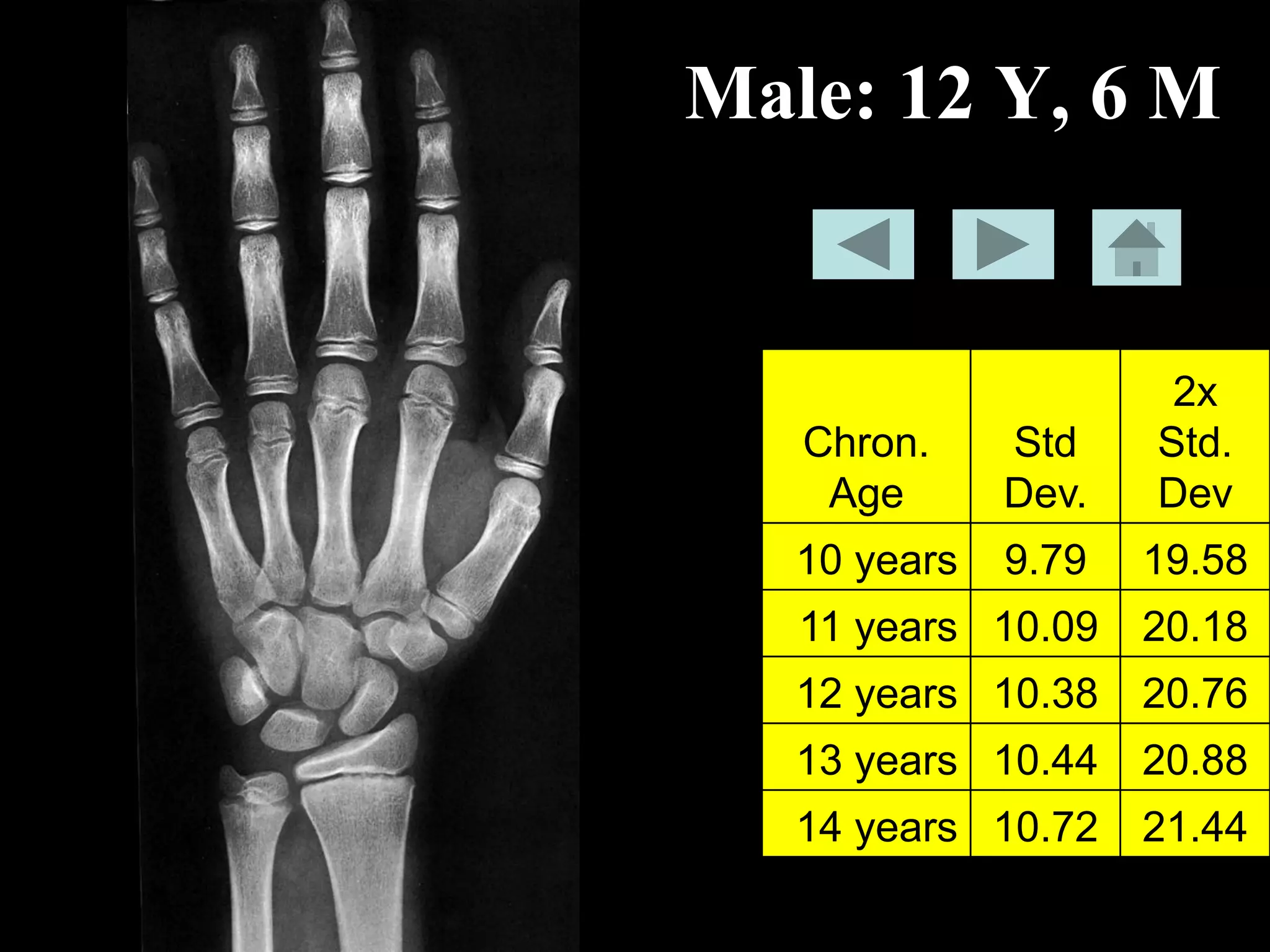 Bone-age-book.pdf
