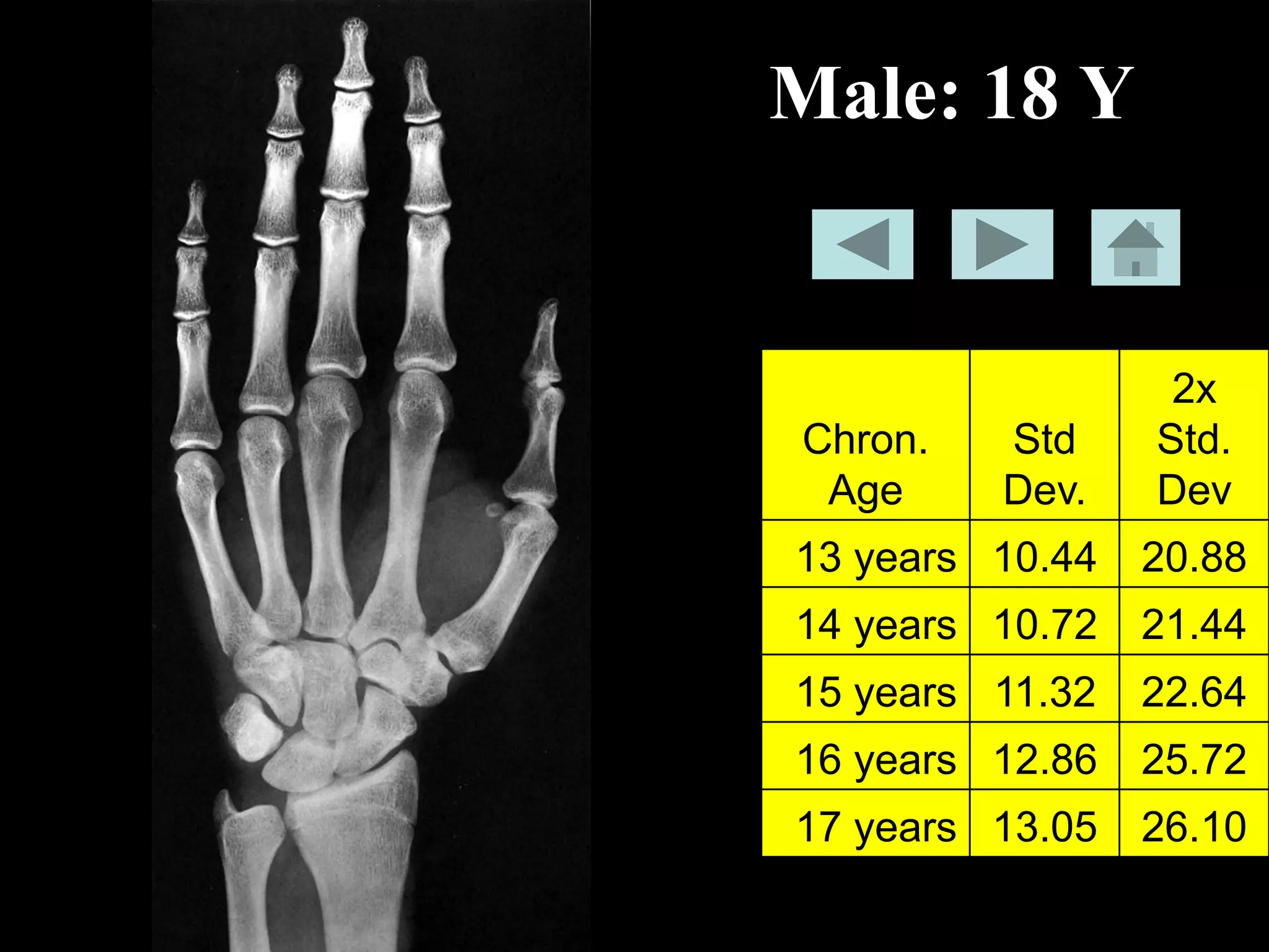 Bone-age-book.pdf