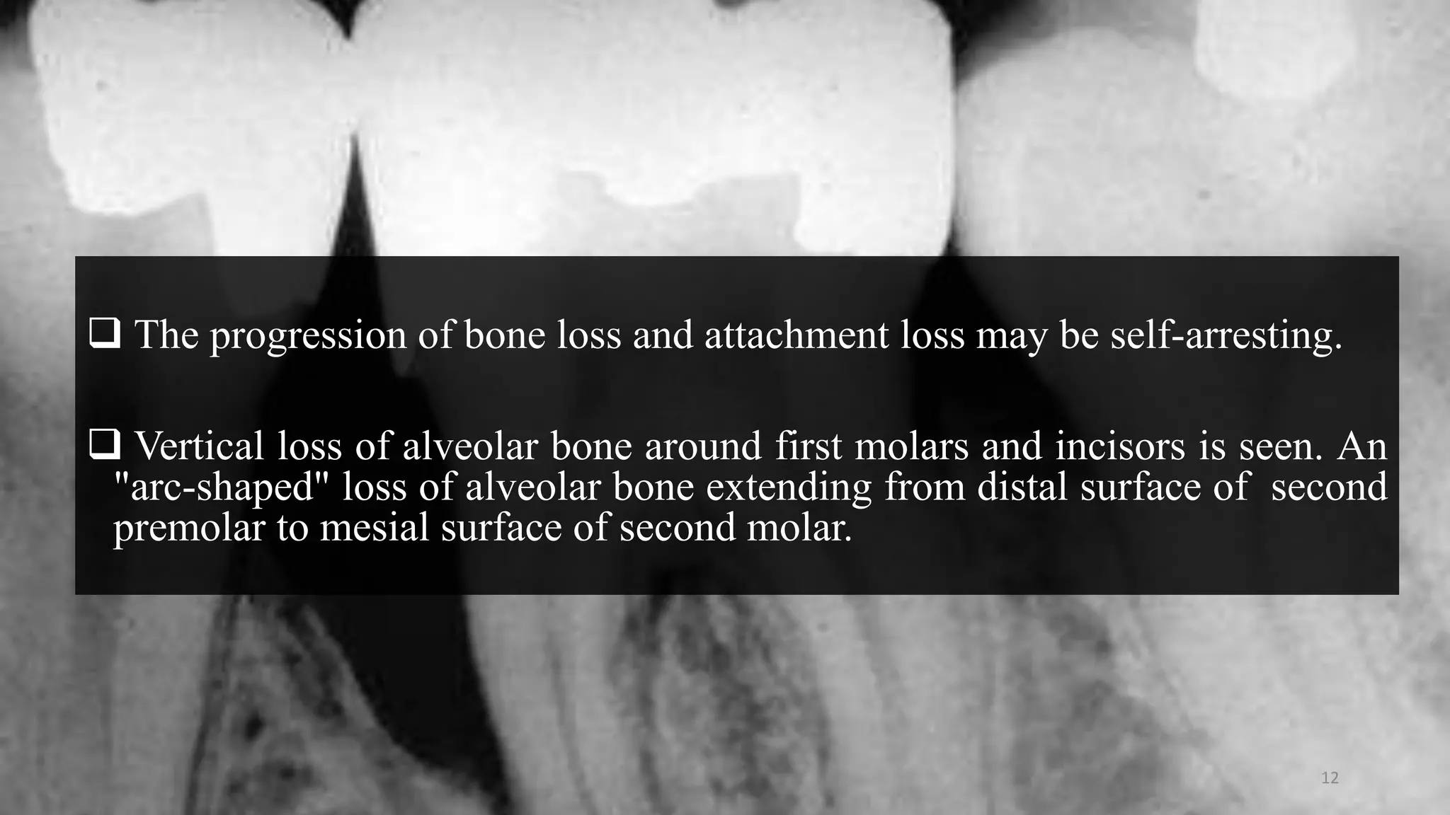 BONE-DESTRUCTION-PATTERNS-20208171318390.pptx