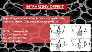 BONE-DESTRUCTION-PATTERNS-20208171318390.pptx